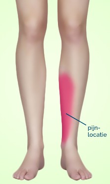 Shin splints (scheenbeenpijn) - Xcelsior Expertise Centrum